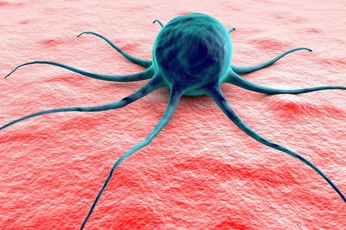 Nowotwory złośliwe – dlaczego są złośliwe? – Fundacja Onkologiczna Alivia